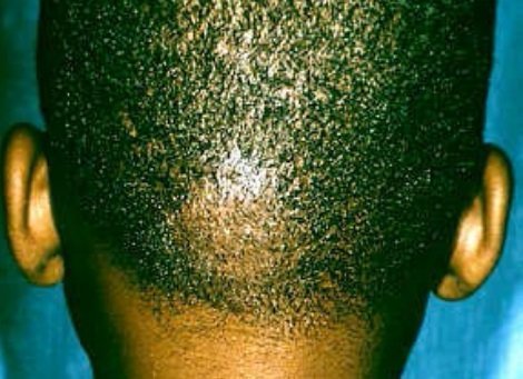 پل ایده‌آل پارس | فرم اکتوتریکسی