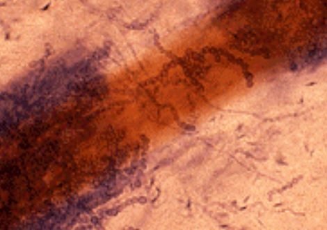 پل ایده‌آل پارس | فرم اکتوتریکسی