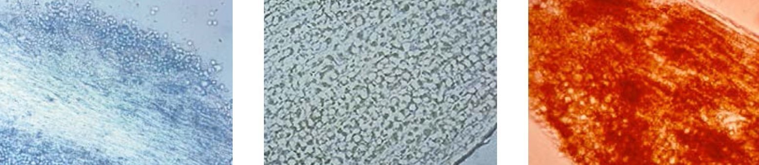 پل ایده‌آل پارس | فرم اندوتریکس