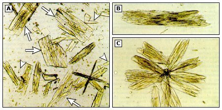 پل ایده‌آل پارس | ایندیناویر