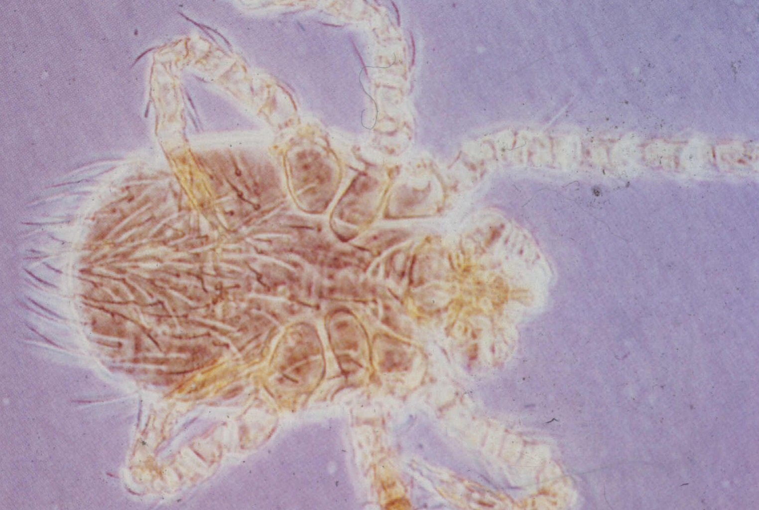 پل ایده‌آل پارس | جنس ترومبیکولا