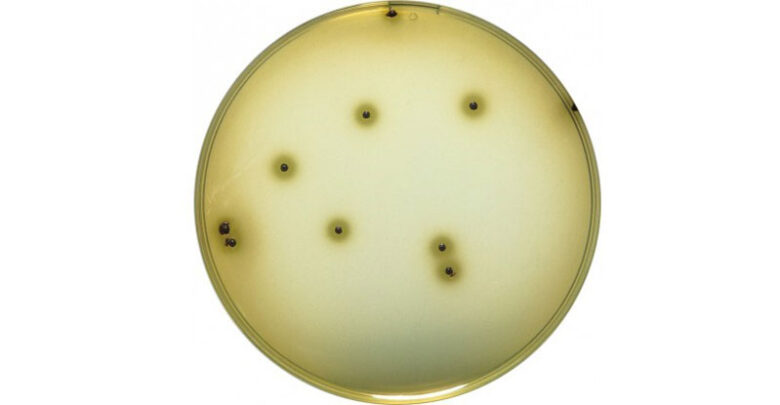 محیط کشت مناسب برای سالمونلا - مجله پل ایده‌آل پارس