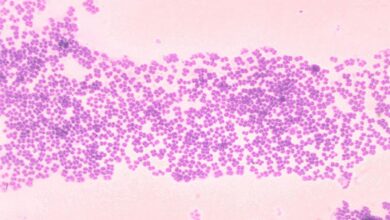 آشنایی با کوکسی گرم مثبت : کوکسی های گرم مثبت مهم در پزشکی کدامند ...
