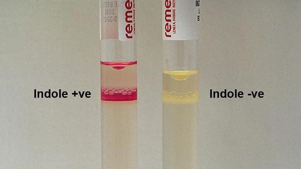 تست IMViC چیست؟ اصول، نمودار نتایج، مثال‌ها و موارد استفاده - مجله پل ...