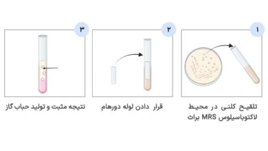 محیط کشت لاکتوباسیلوس MRS براث: اصول و نحوه استفاده - مجله پل ایده‌آل پارس