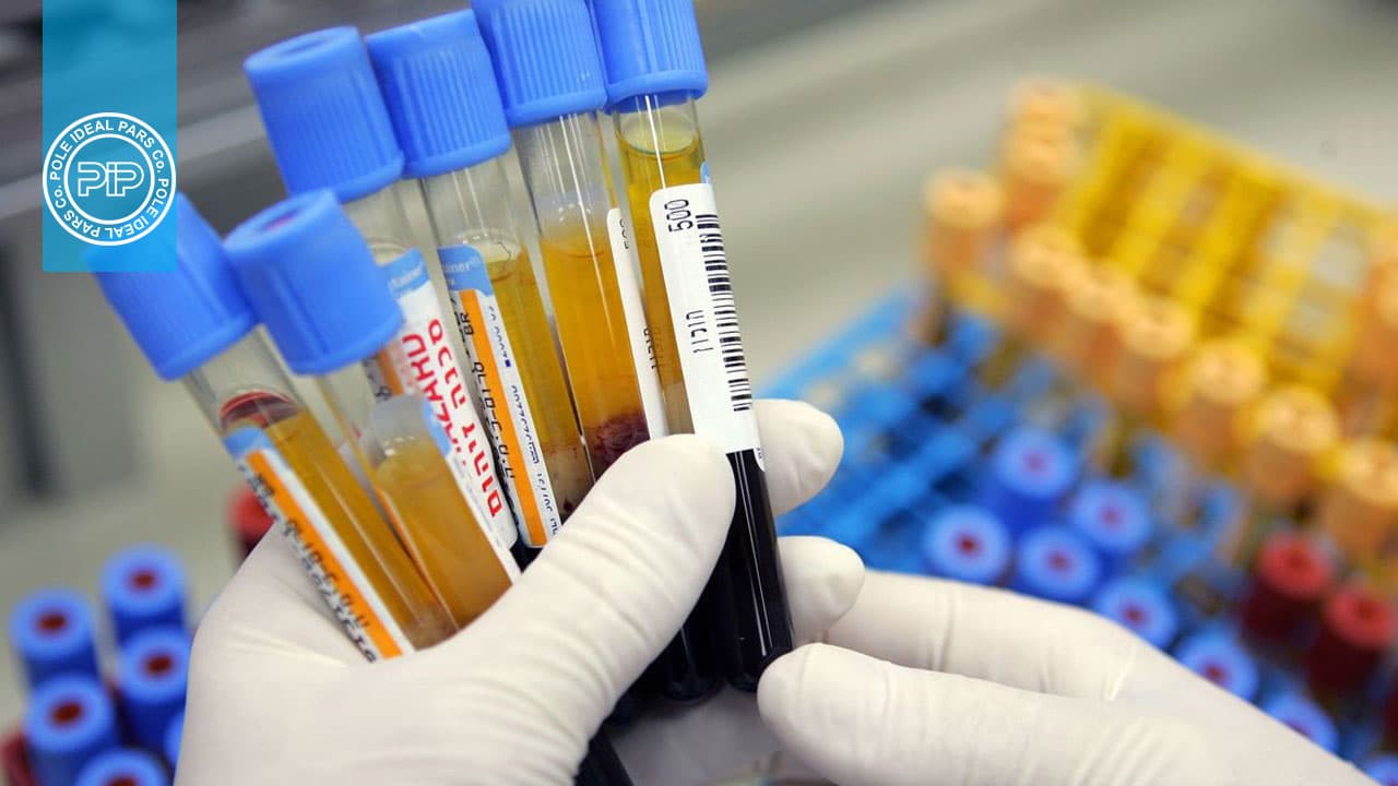 آیا آزمایش سیستم ایمنی بدن لازم است؟ علت انجام آن چیست؟ - مجله پل ایده ...