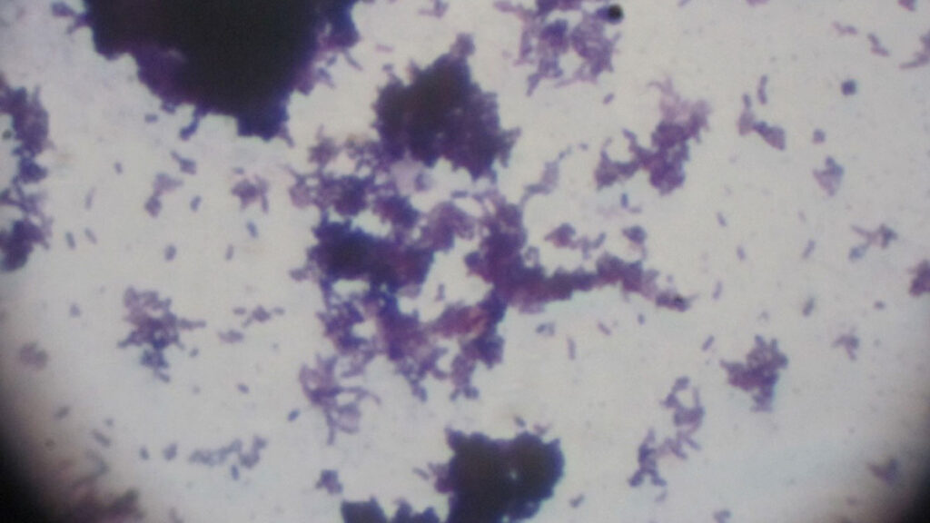 مروری بر کورینه باکتریوم گزروزیس - مجله پل ایده‌آل پارس آزمایش‌ها و ...