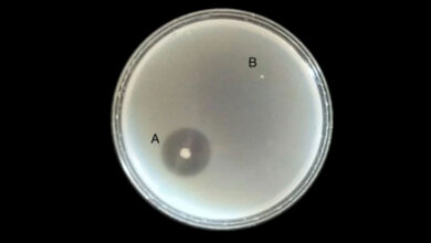 آزمایش هیدرولیز ژلاتین : اصول، روش و نتایج مورد نظر - مجله پل ایده‌آل پارس